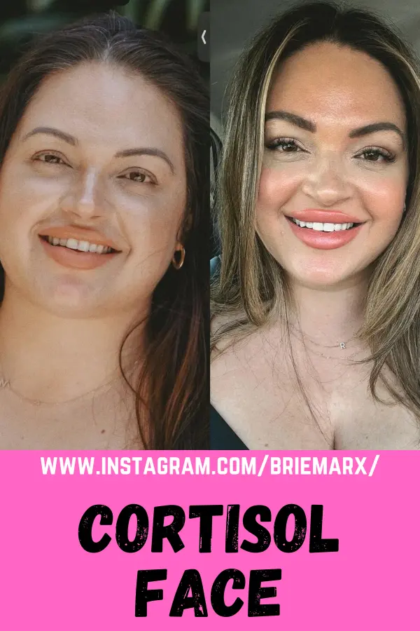 Do You Really Suffer From Cortisol Face?